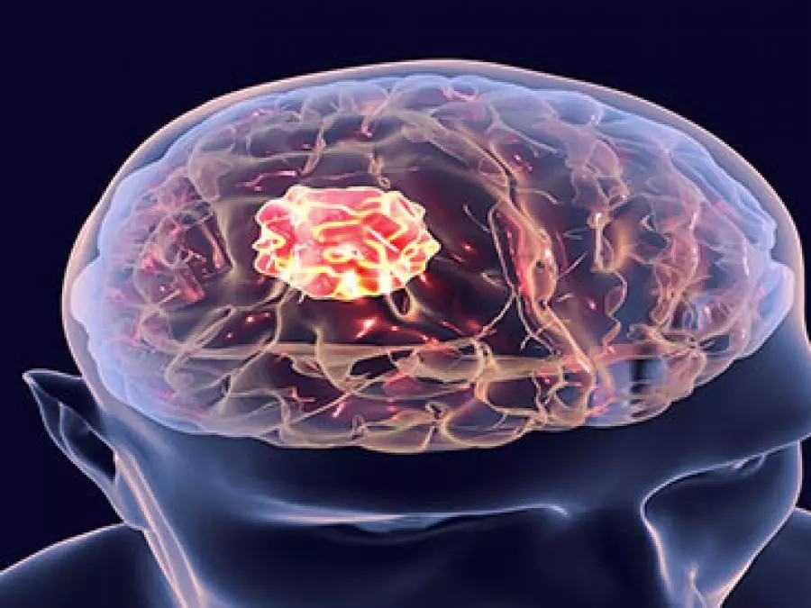 كشفٌ عن دواء نفساني لعلاج سرطان الدماغ - EDDIWAN